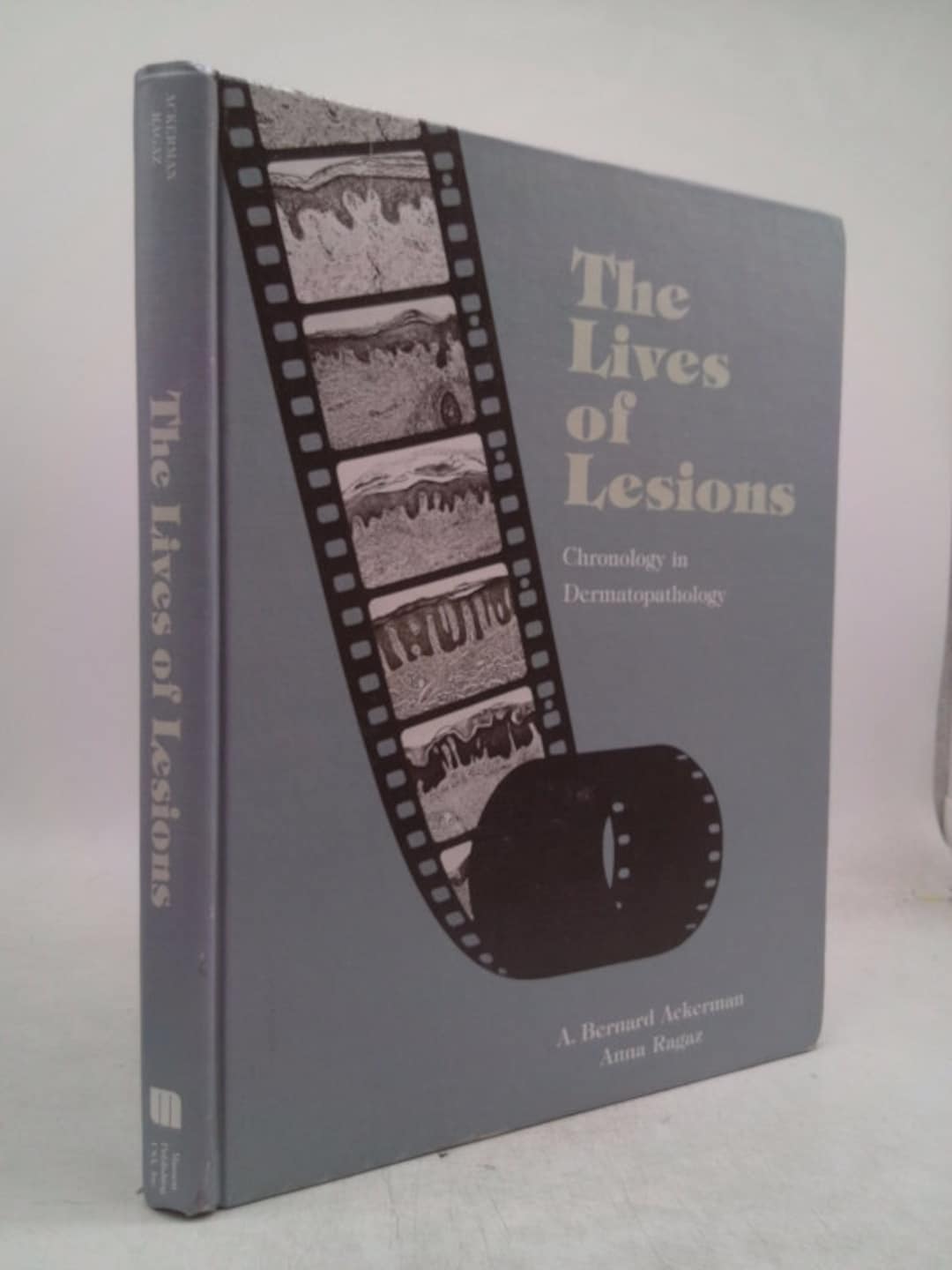 The Lives of Lesions: A Chronology in Dermatophathology by A. Bernard ...