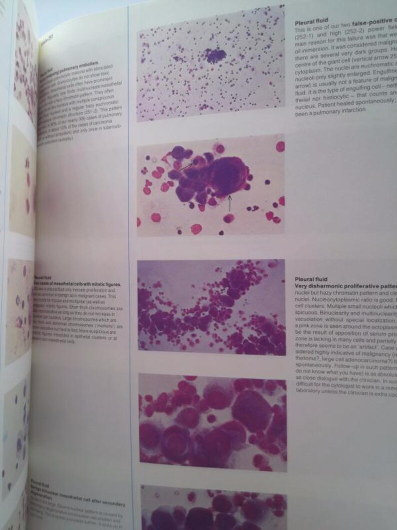 Atlas of Clinical Cytology: A Contribution to Precise Cytodiagnosis and ...