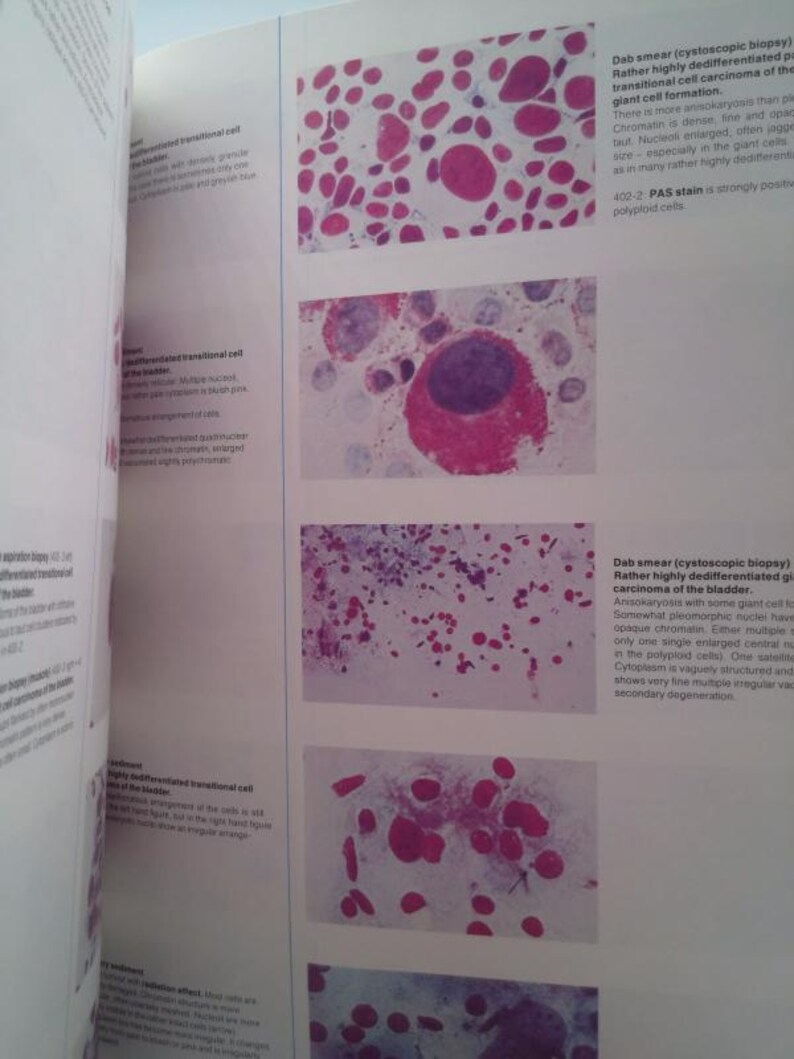 Atlas of Clinical Cytology: A Contribution to Precise Cytodiagnosis and ...