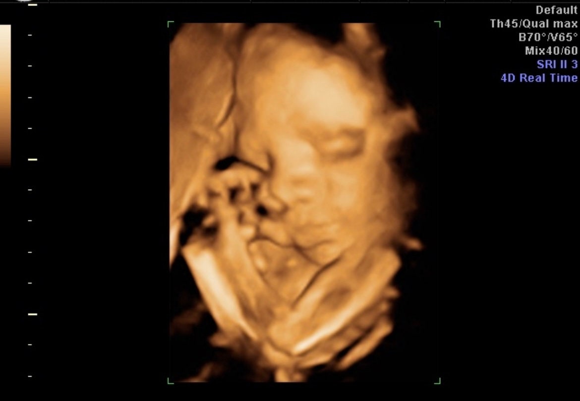 Baby 8K/8D Real Ultrasound - Etsy