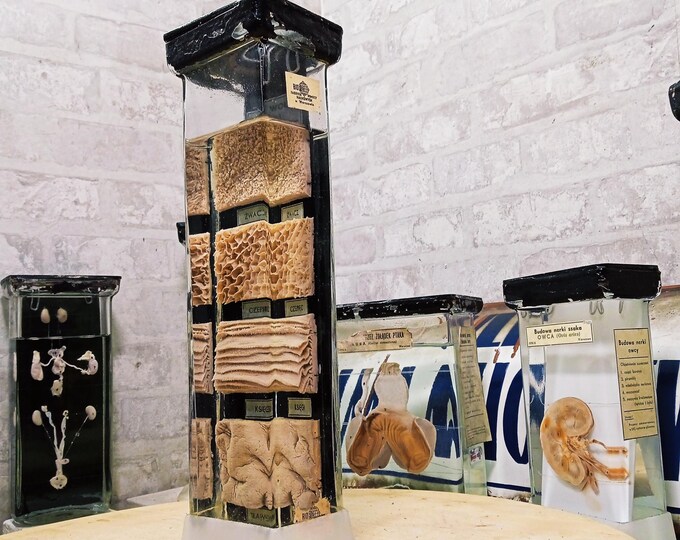 Anatomical Stomach Tissue Model Preserved in Formalin, Rare Scientific ...