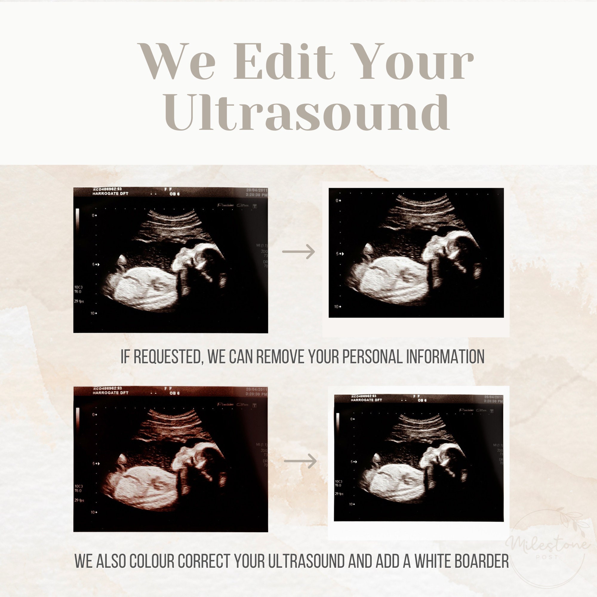 IVF Pregnancy Announcement Social Media Post Baby | Etsy