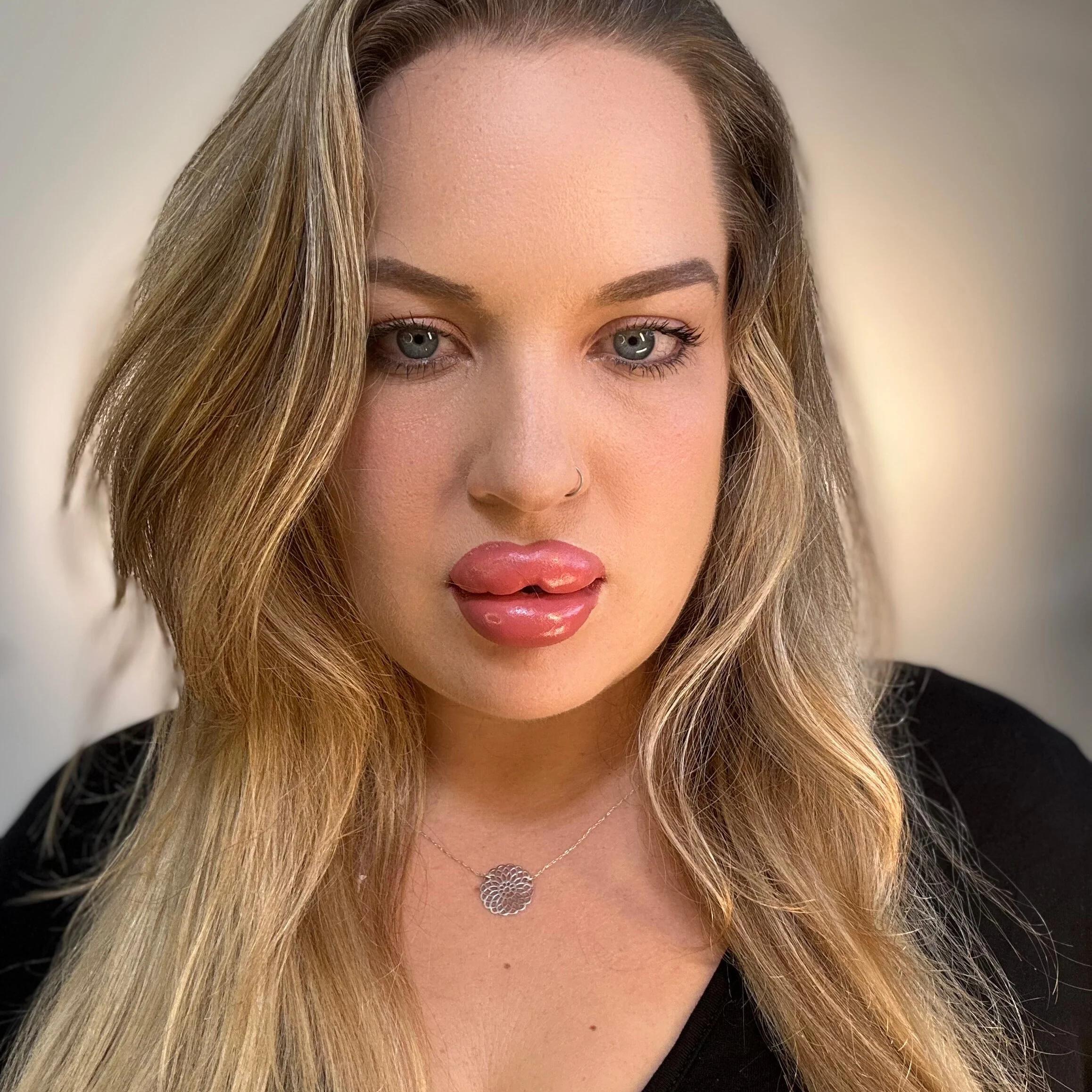 The Botched Lips | SFX Make up | Silicone Prosthetics | Lip Filler ...