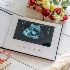Linen Baby Video Book, Baby Scan, Ultra Sound Video Clips, New Born ...