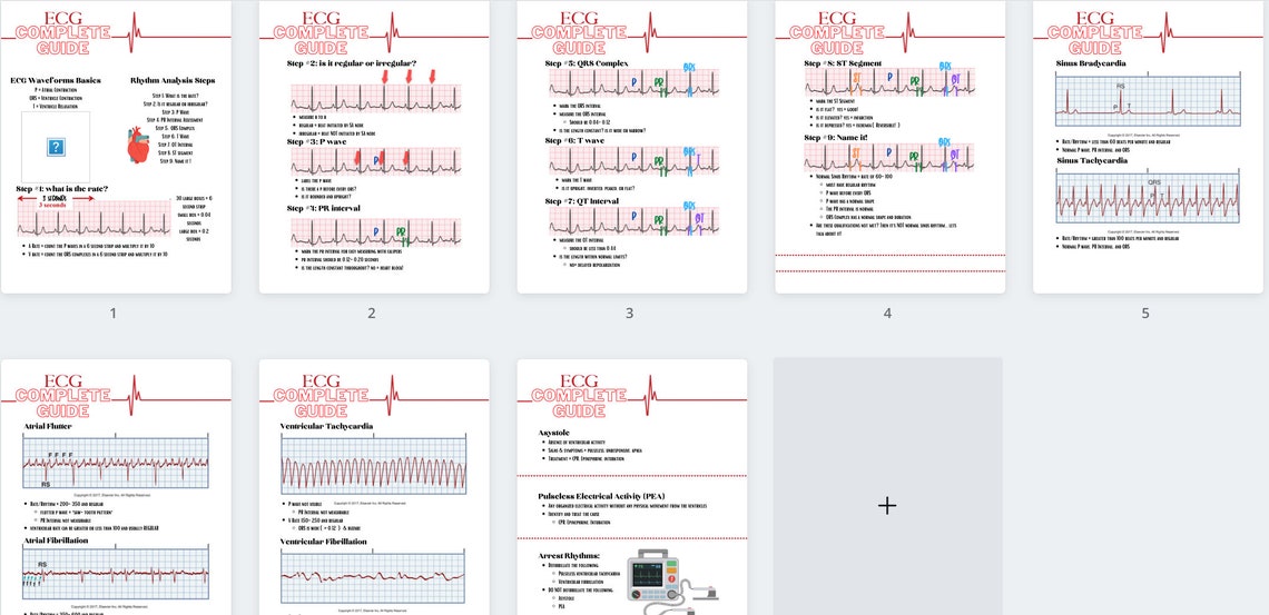 ECG/EKG Interpretation Complete Guide Nursing School Cardiac - Etsy