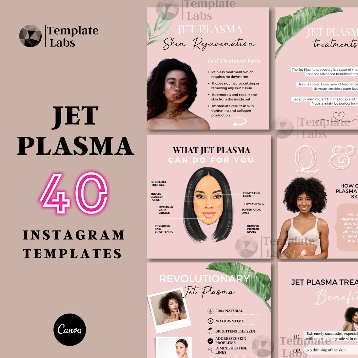 Jet Plasma Instagram Post Canva Template Edit in Canva - Etsy