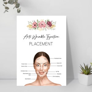 Botox Injection Site, Botox Illustration, Botox Poster, Botox Wall Art ...