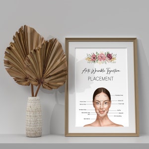 Botox Injection Site, Botox Illustration, Botox Poster, Botox Wall Art ...