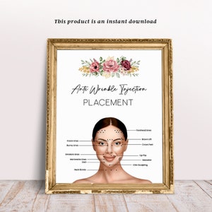 Botox Injection Site, Botox Illustration, Botox Poster, Botox Wall Art ...