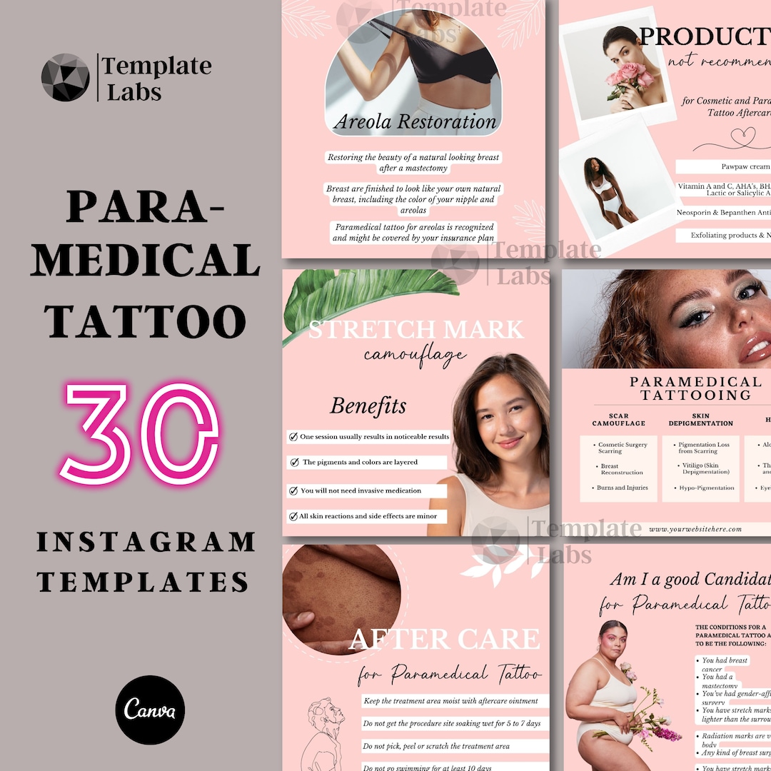 Paramedical Tattoo Stretch Mark Camouflage Areola Tattoo - Etsy