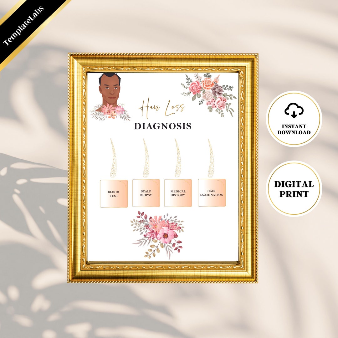 Hair Transplant Wall Art, Scalp Treatment Poster, Hair Loss Treatment ...