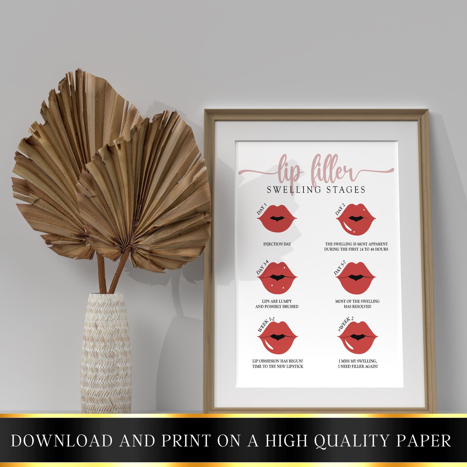 Lip Filler Aftercare Poster Lip Filler Journey Lips - Etsy
