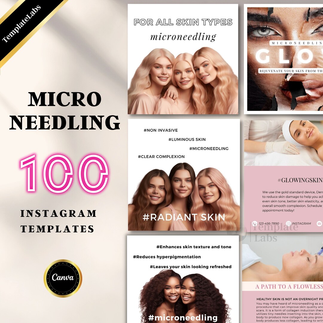 Microneedling Social Media Post, Microneedling Instagram, Microneedling ...