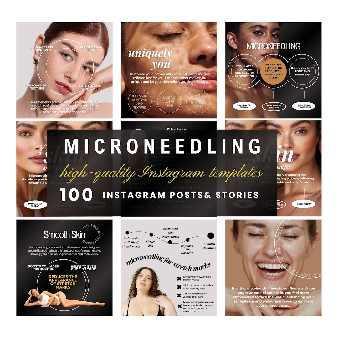 Microneedling Social Media Post, Microneedling Instagram, Microneedling ...