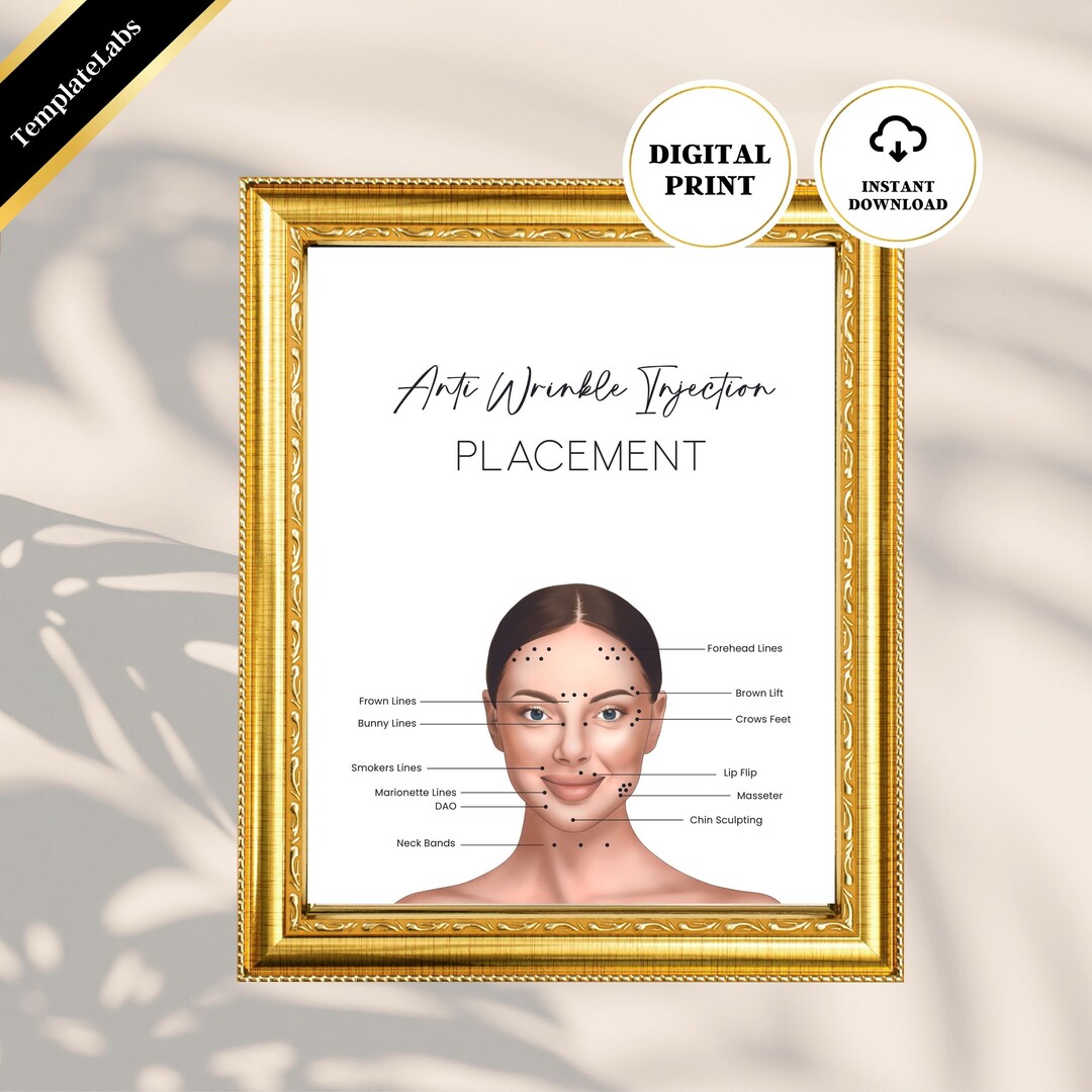 Botox Injection Site Botox Illustration Botox Poster Botox - Etsy