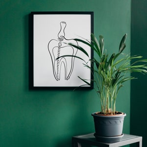 Dental Art Print, Root Canal Therapy Drawing, Dental Surgeon Gift ...