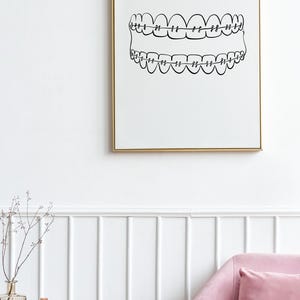 Teeth With Braces One Line Drawing, Printable Dental Wall Art ...