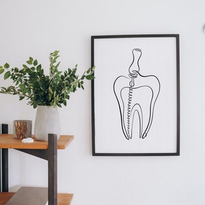Dental Art Print, Root Canal Therapy Drawing, Dental Surgeon Gift ...