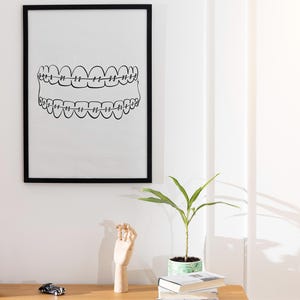 Teeth With Braces One Line Drawing, Printable Dental Wall Art ...
