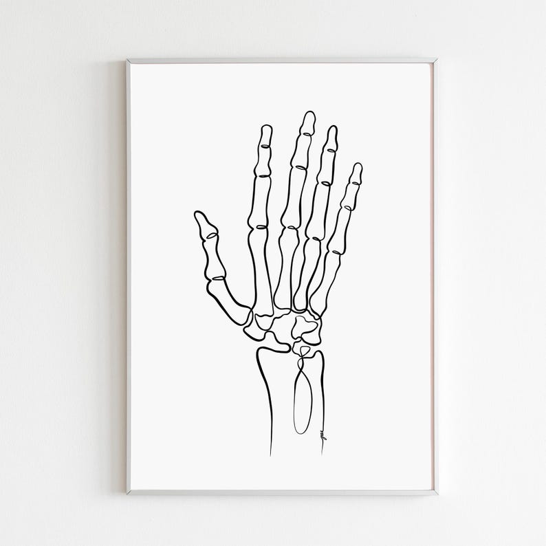 Hand Bone Anatomy Wall Art Print, Orthopedic Artwork, Chiropractic ...