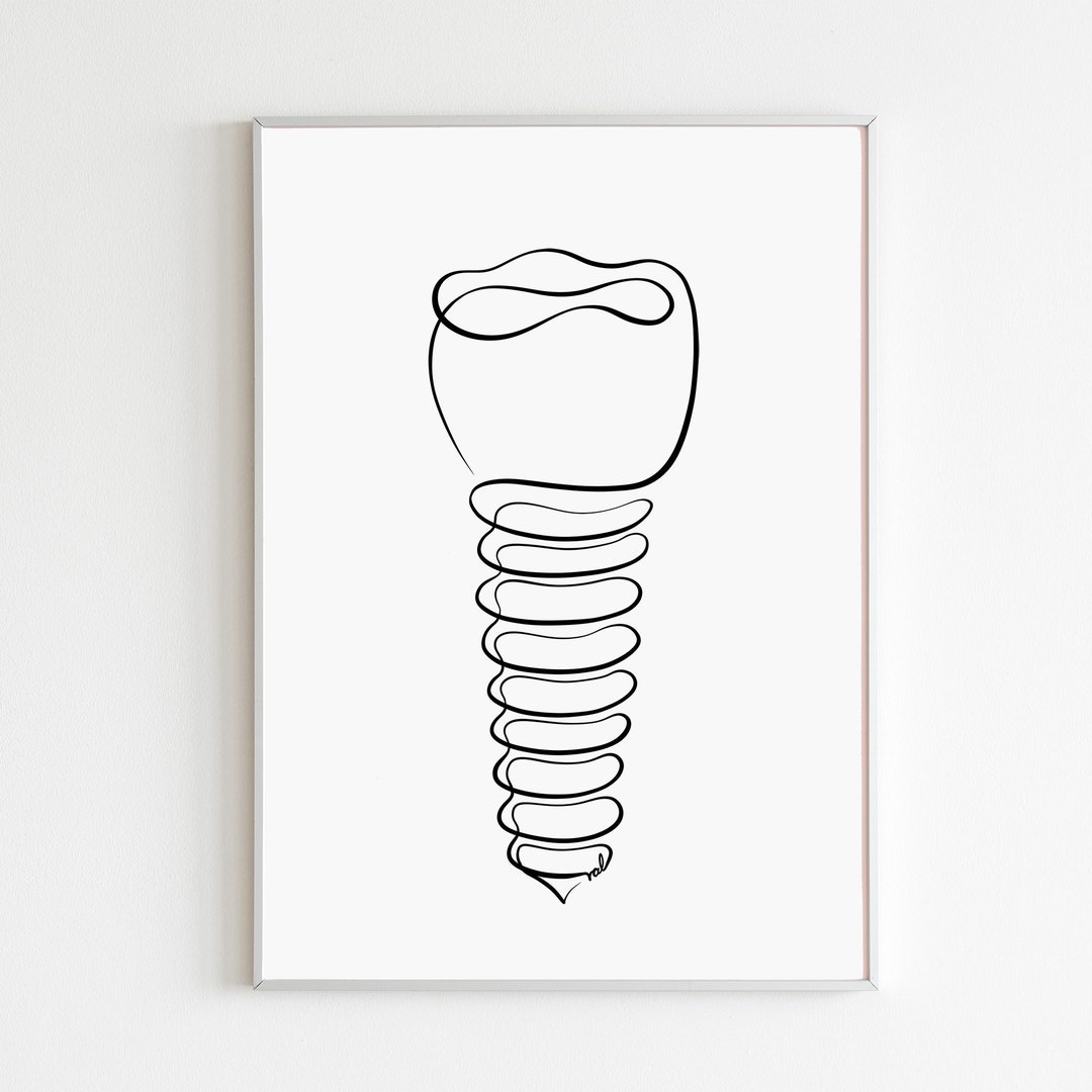 Dental Implant Art Print, Dental Surgery Gift for Dentist Office Decor ...