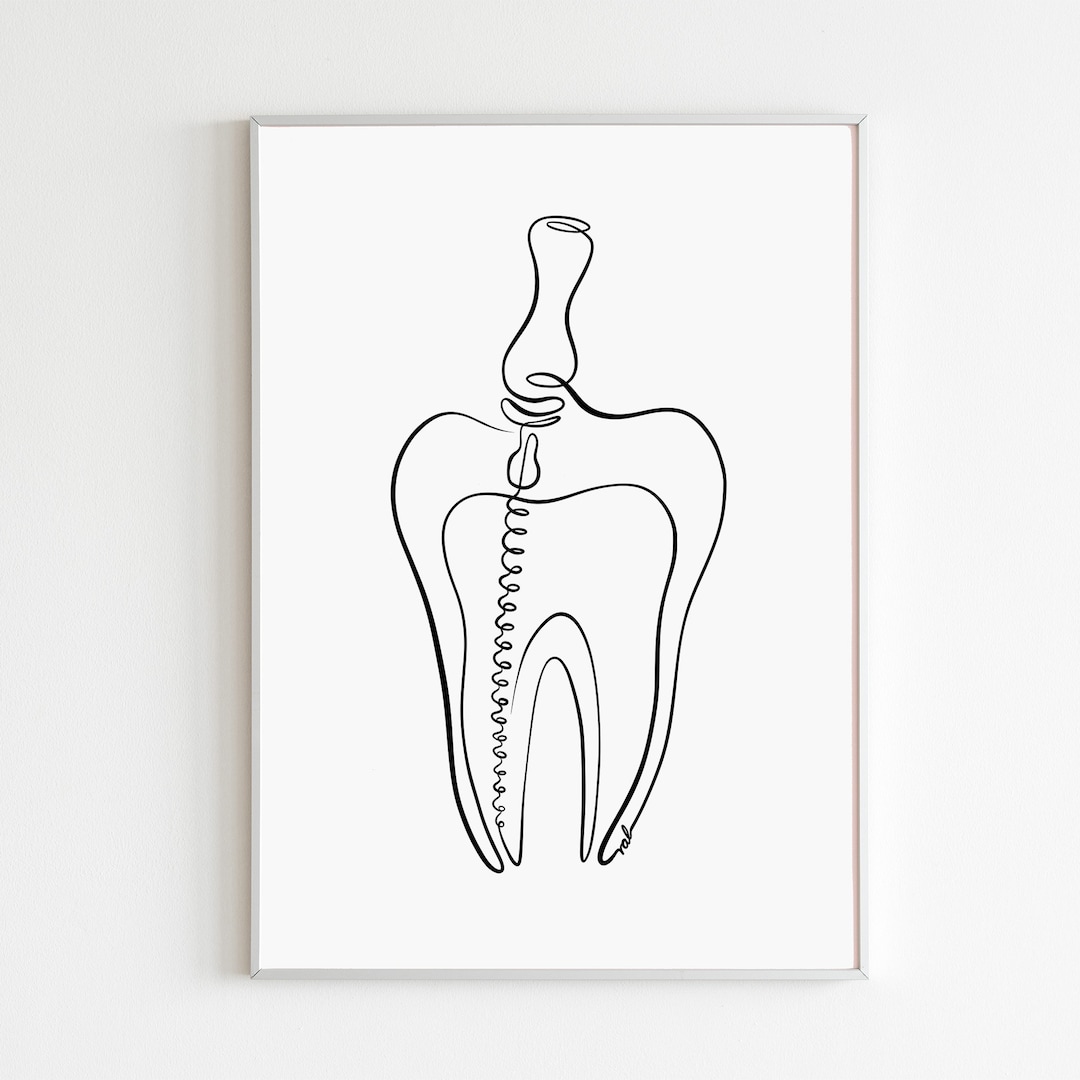 Dental Art Print, Root Canal Therapy Drawing, Dental Surgeon Gift ...