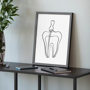 Dental Art Print, Root Canal Therapy Drawing, Dental Surgeon Gift ...