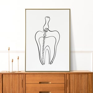 Dental Art Print, Root Canal Therapy Drawing, Dental Surgeon Gift ...
