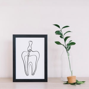 Dental Art Print, Root Canal Therapy Drawing, Dental Surgeon Gift ...