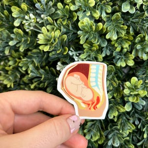 Anatomical Pregnancy Healthcare/ Nursing Sticker - Etsy