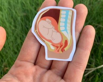 Naughty CAUTI Catheter Nursing/healthcare Sticker - Etsy