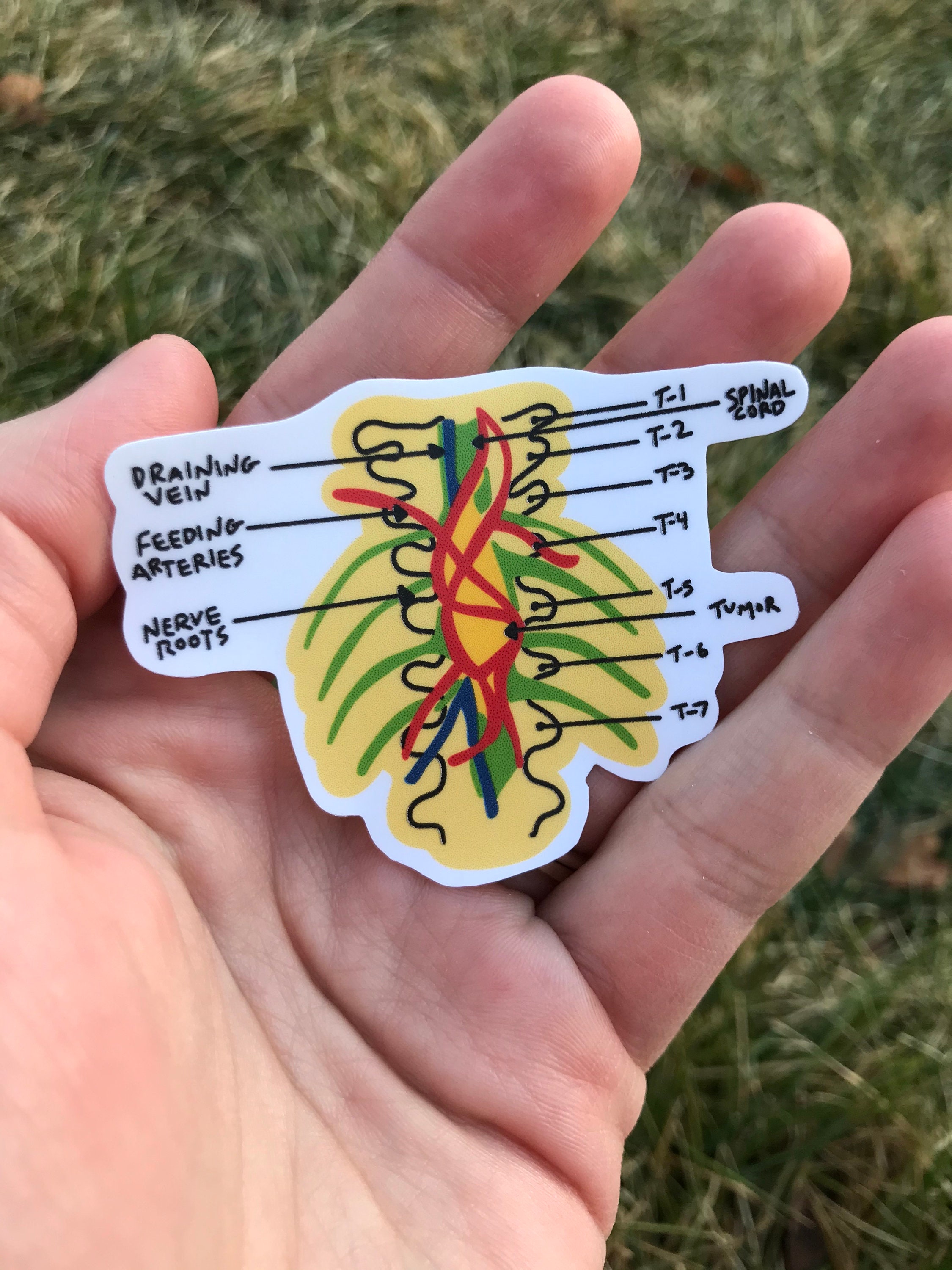 Grey's Anatomy Tumor Sticker - Etsy