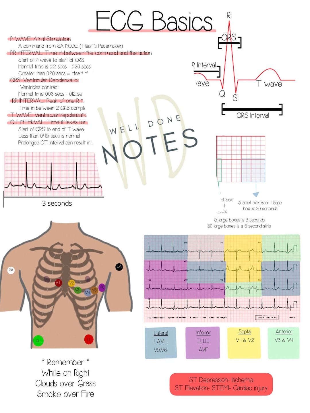 EKG BASICS Study Guide - Etsy