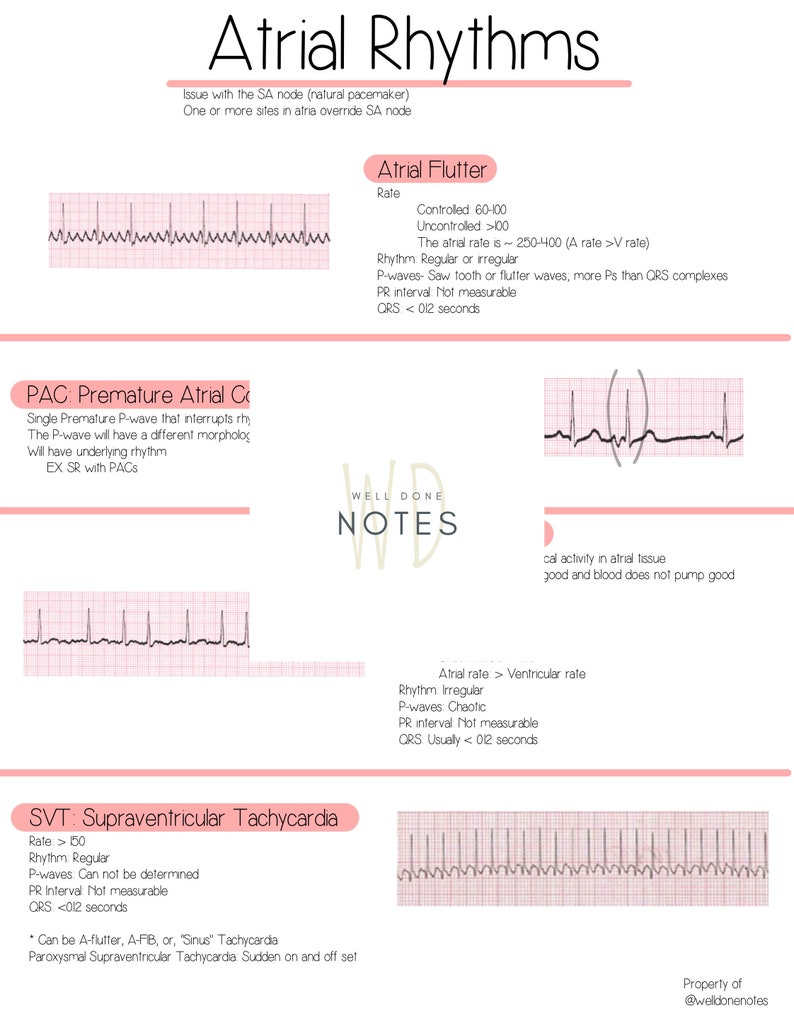 ACLS Study Guide and EKG Basics - Etsy