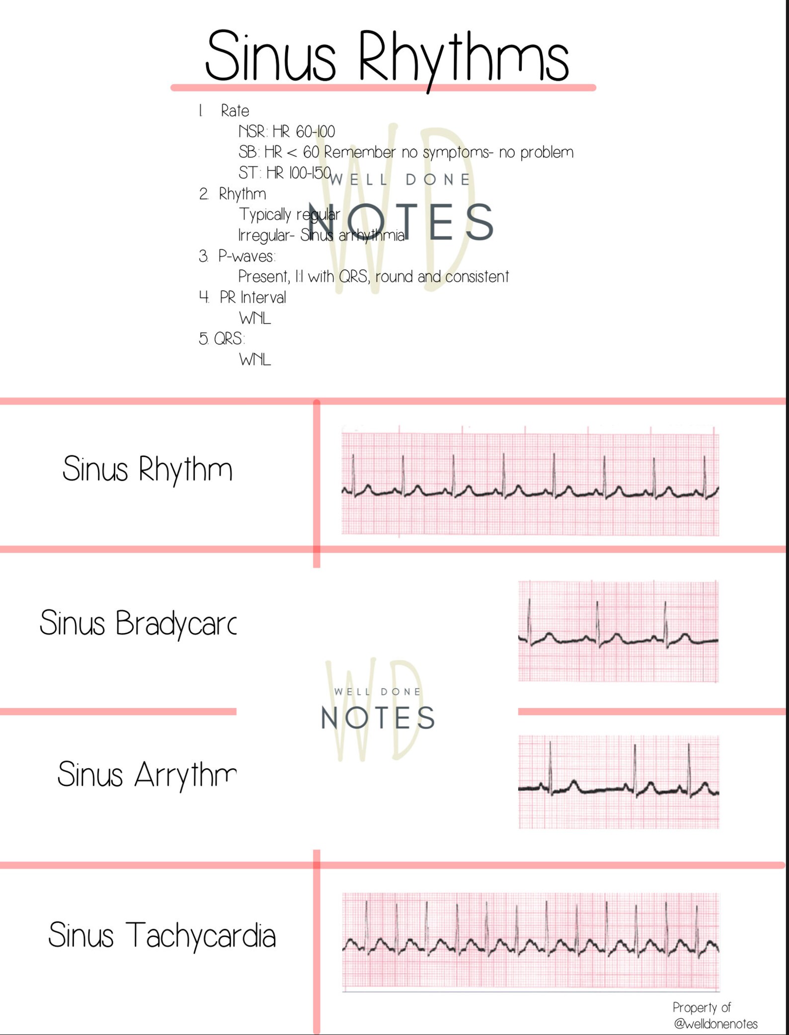 EKG BASICS Study Guide - Etsy