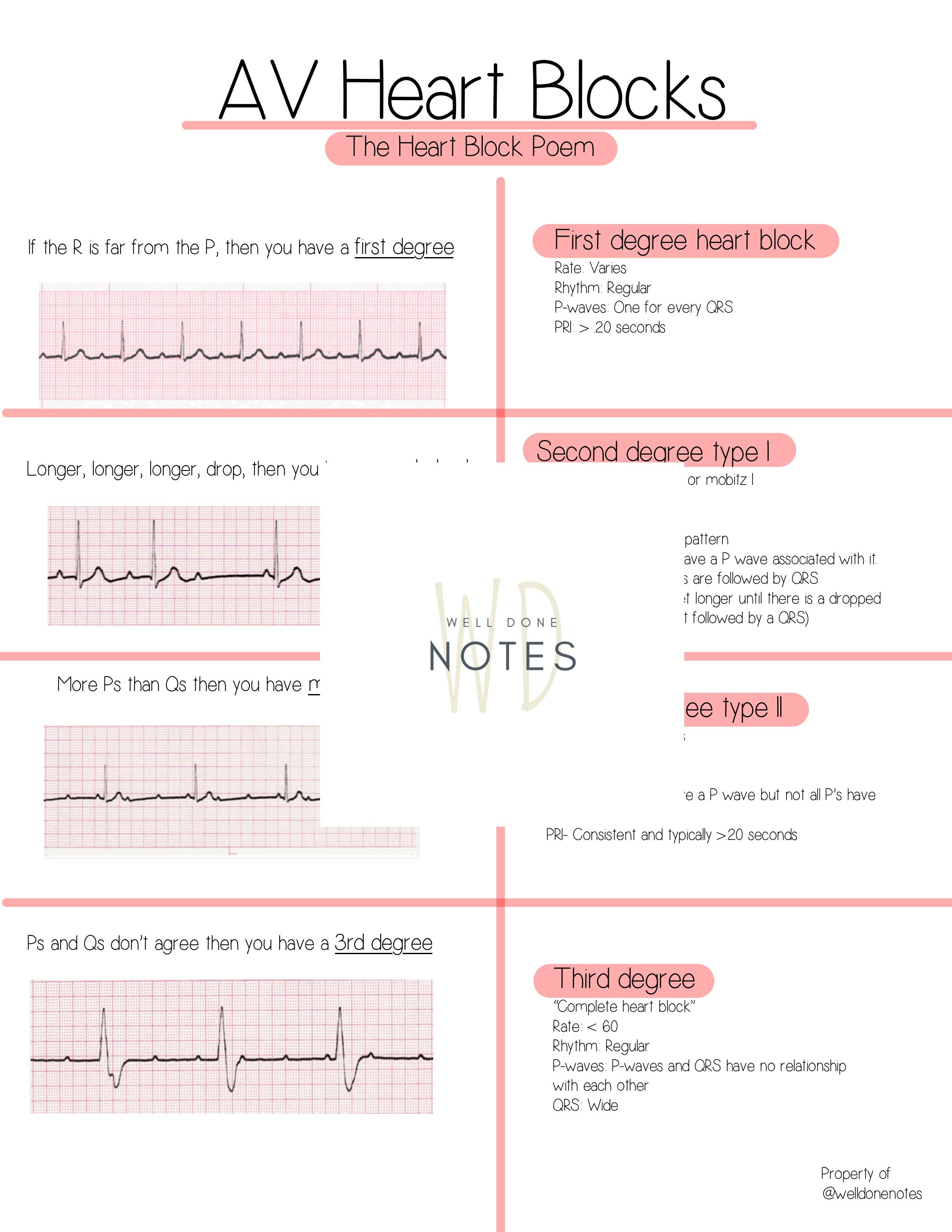 ACLS Study Guide and EKG Basics - Etsy