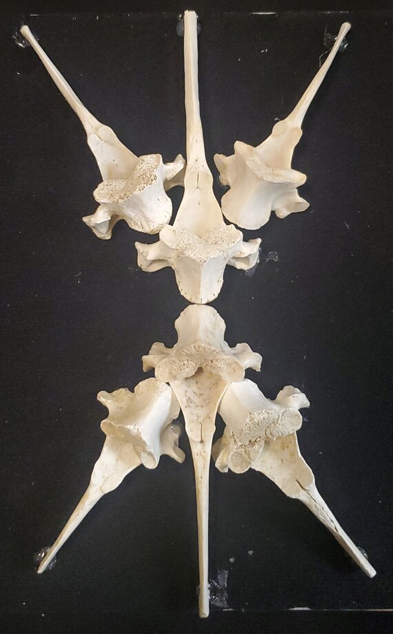 Spine Design Shadow Box - Etsy