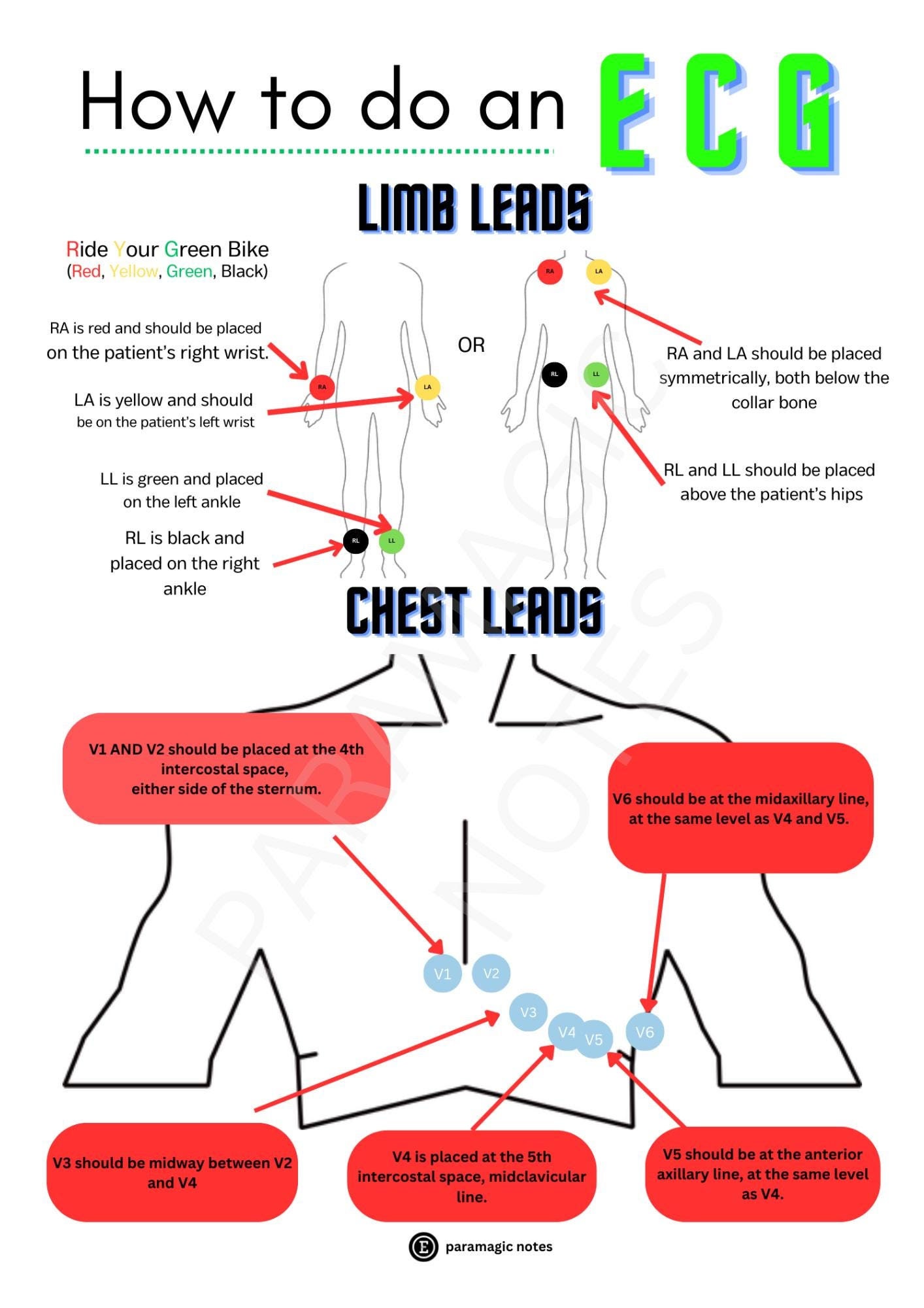 How to Perform an ECG/EKG, ECG Placement Guide Revision Poster - Etsy