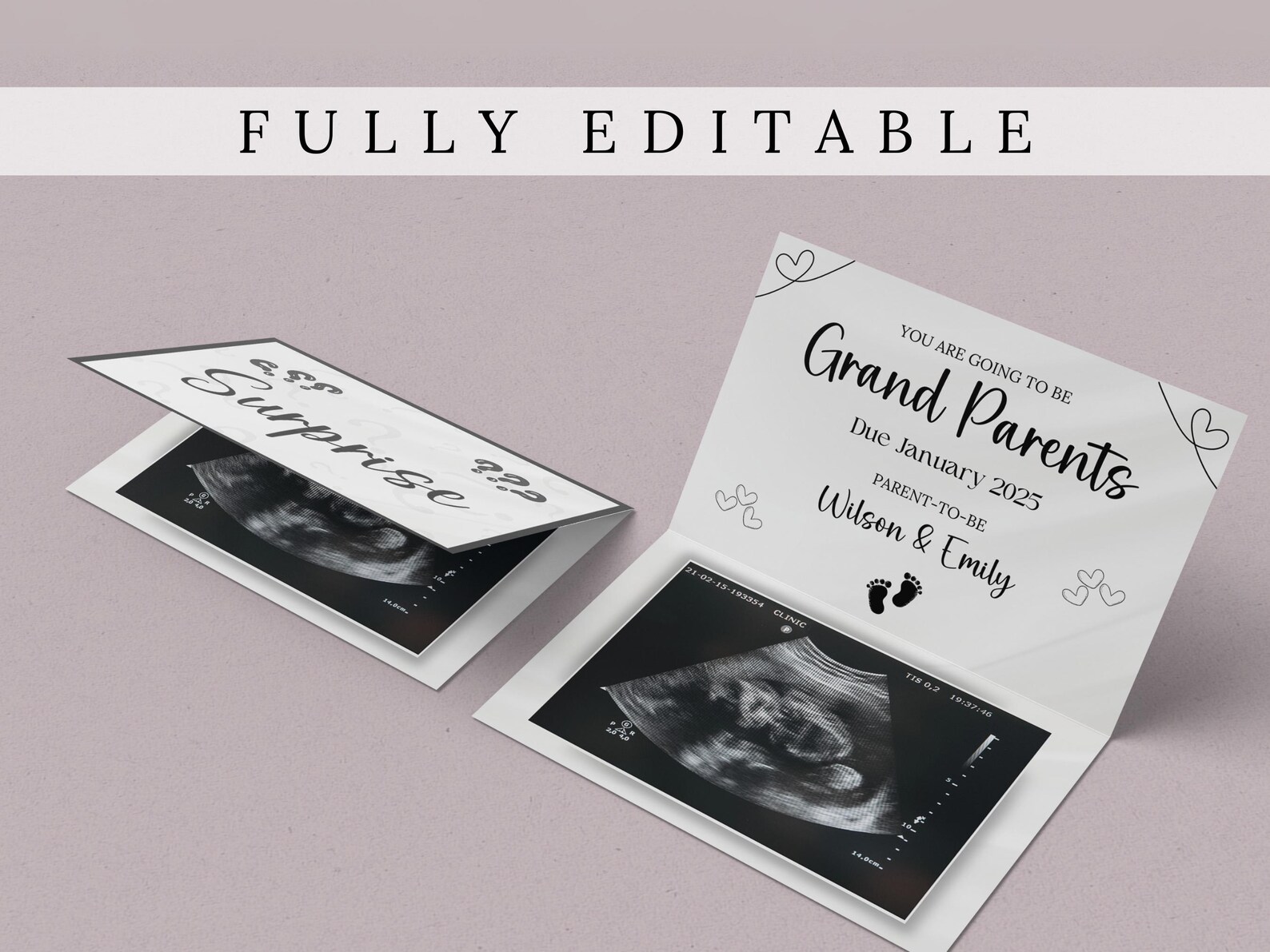 Pregnancy Announcement Card Template | Editable Pregnancy Reveal ...