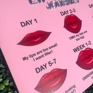 LIP FILLER JOURNEY, Business Sign, Aesthetics - Etsy