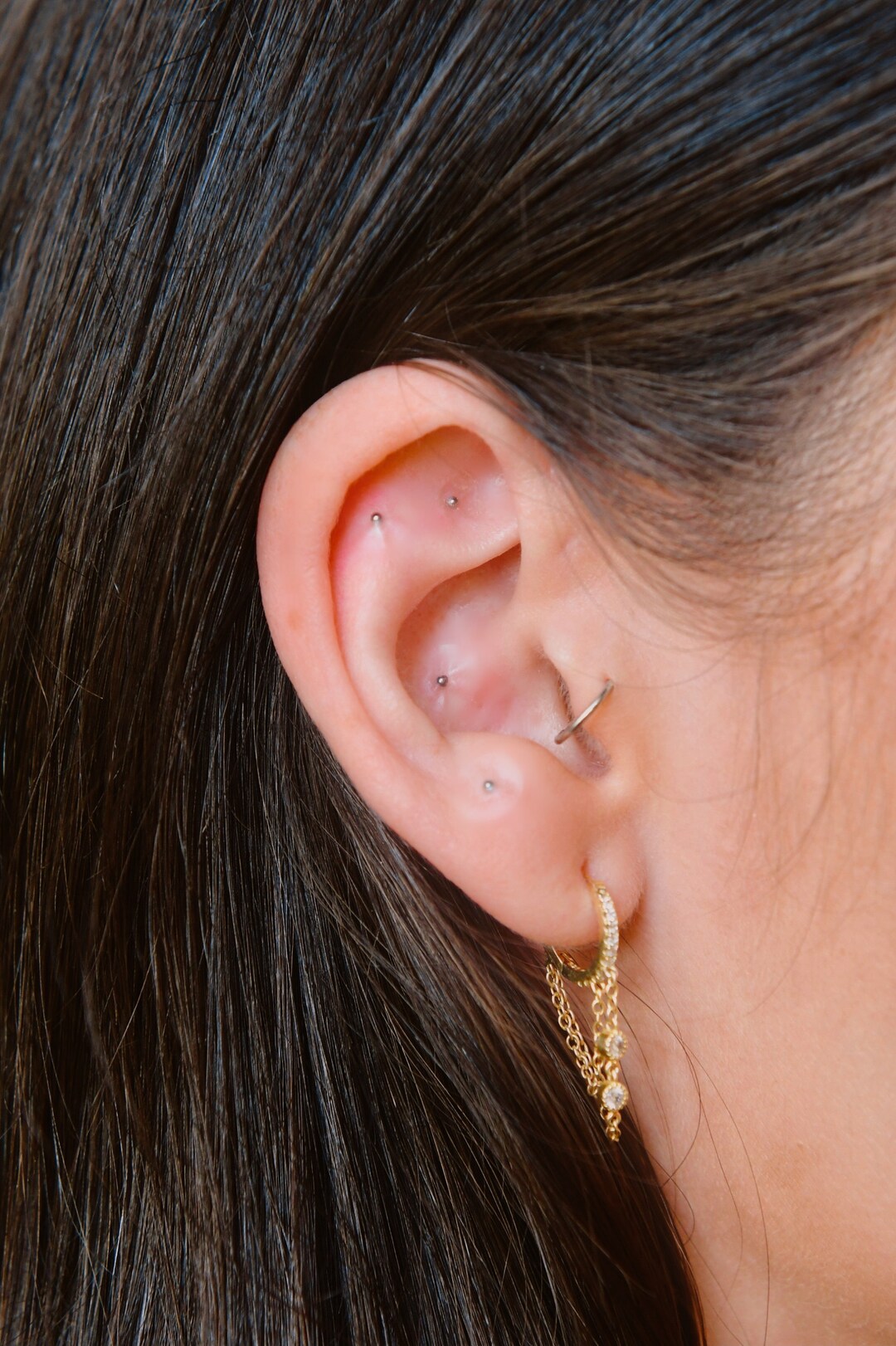 Silver Ear Seeds Kit: Acupressure Helps Stress, Anxiety, Insomnia ...