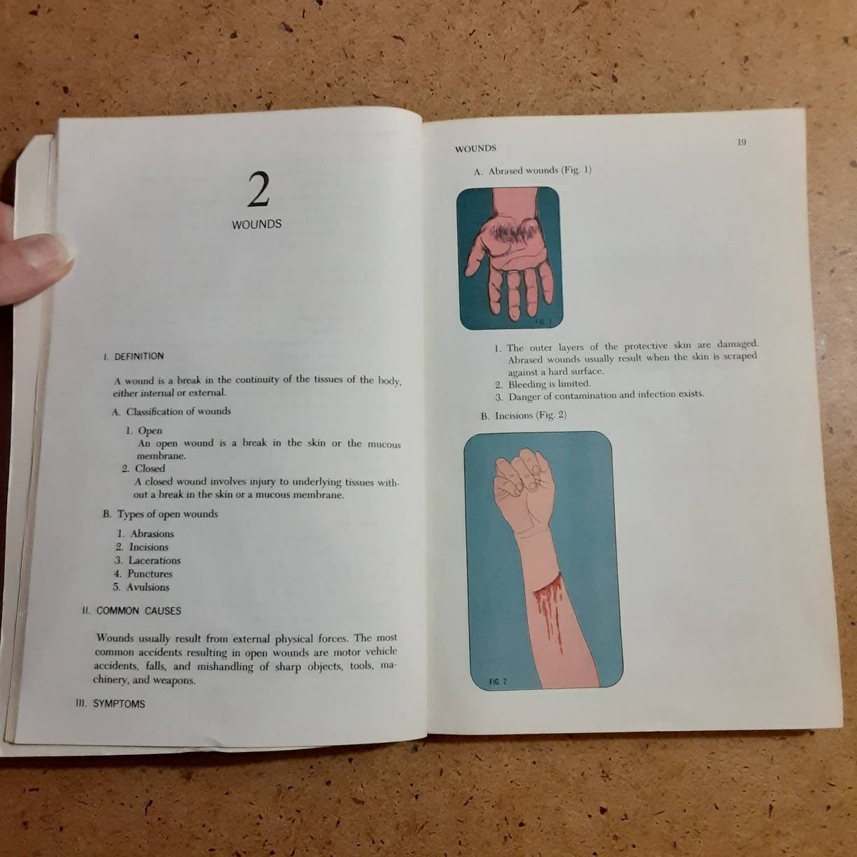 1979 American Red Cross First Aid Text-book Second Edition for - Etsy