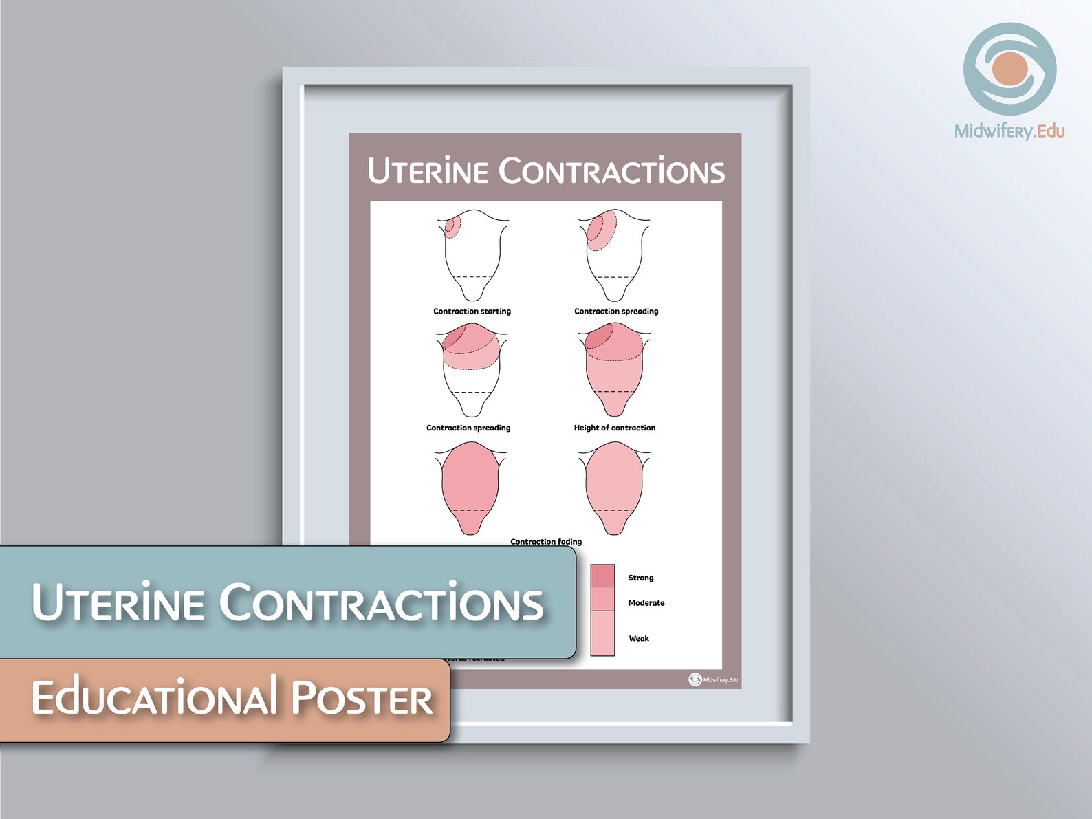 Uterine Contractions Educational Poster - Etsy