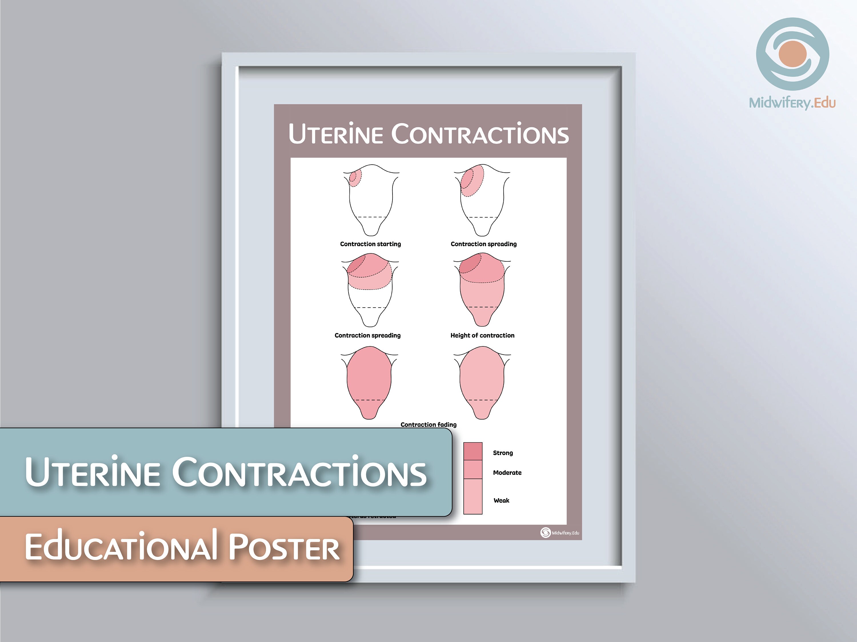 Uterine Contractions Educational Poster Etsy Uterine Contractions Educational Poster Etsy
