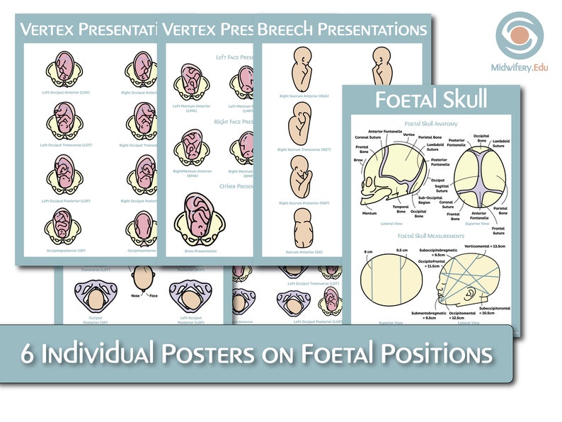 Foetal/Fetal Position Study Bundle Educational Poster | Etsy