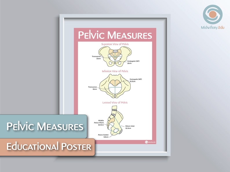 Pelvic Measures Educational Poster - Etsy