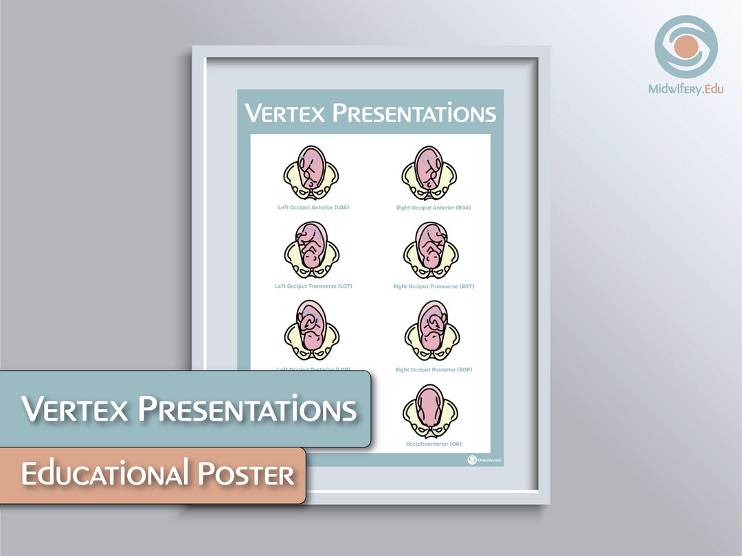 Vertex Presentations - Etsy