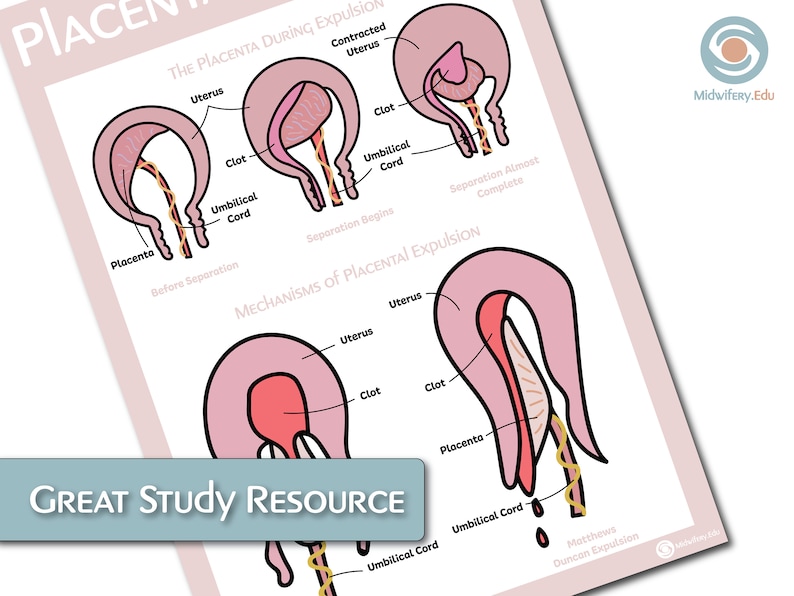Placenta Educational Poster Study Bundle - Etsy