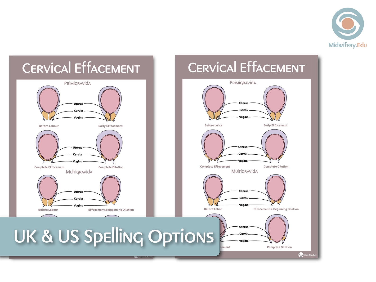 Cervical Effacement Educational Poster - Etsy