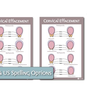 Cervical Effacement Educational Poster - Etsy UK